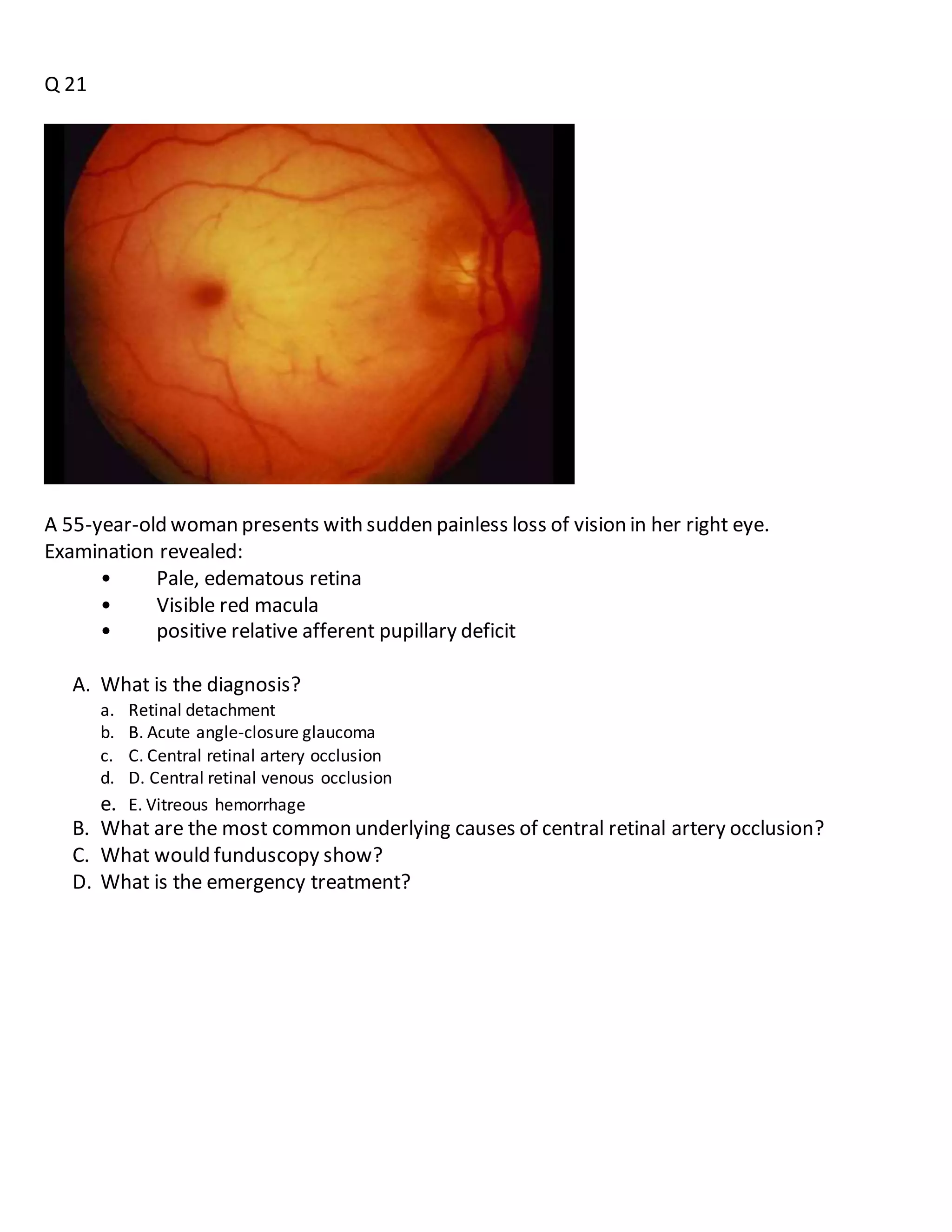 OSCE ophthalmology examination & answers | DOCX