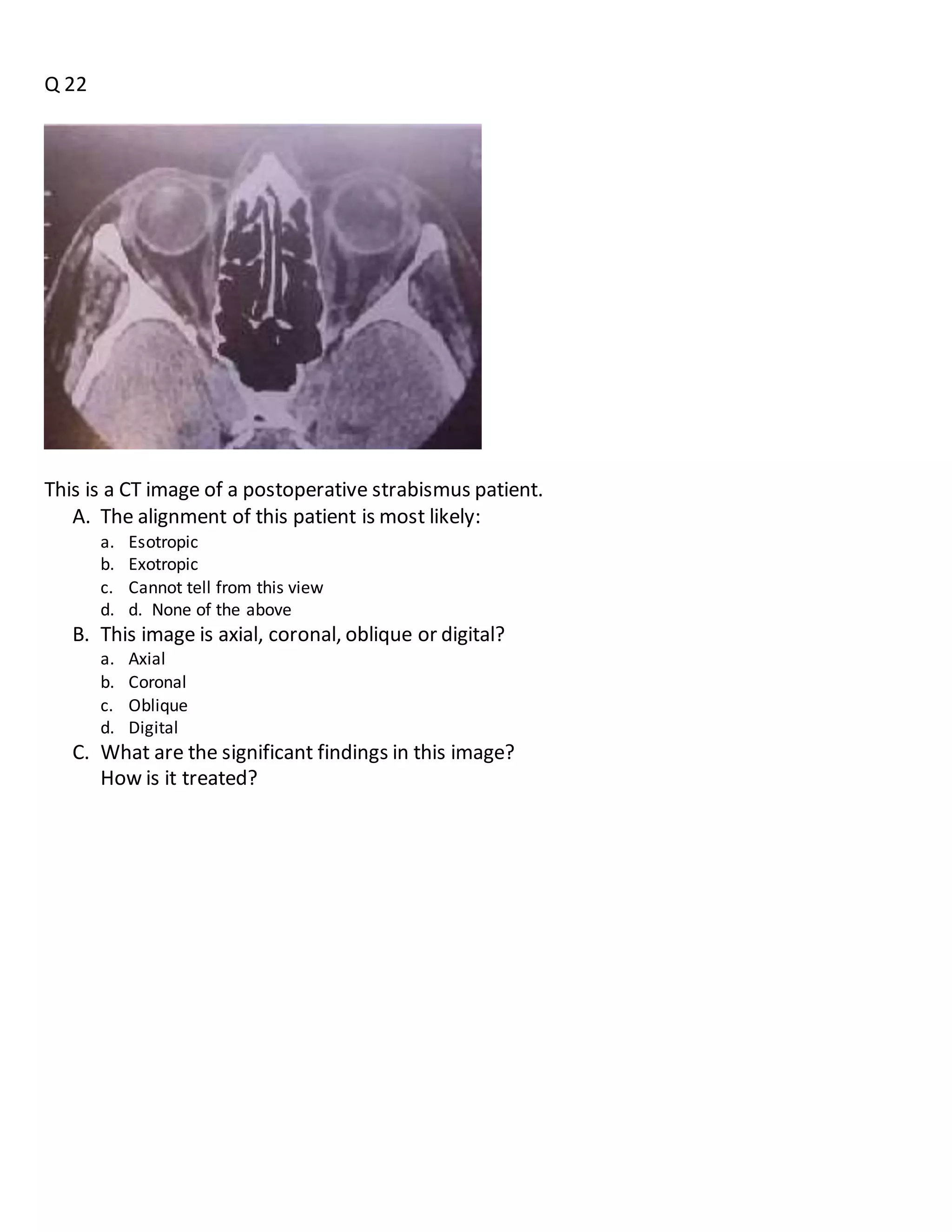 OSCE ophthalmology examination & answers | DOCX