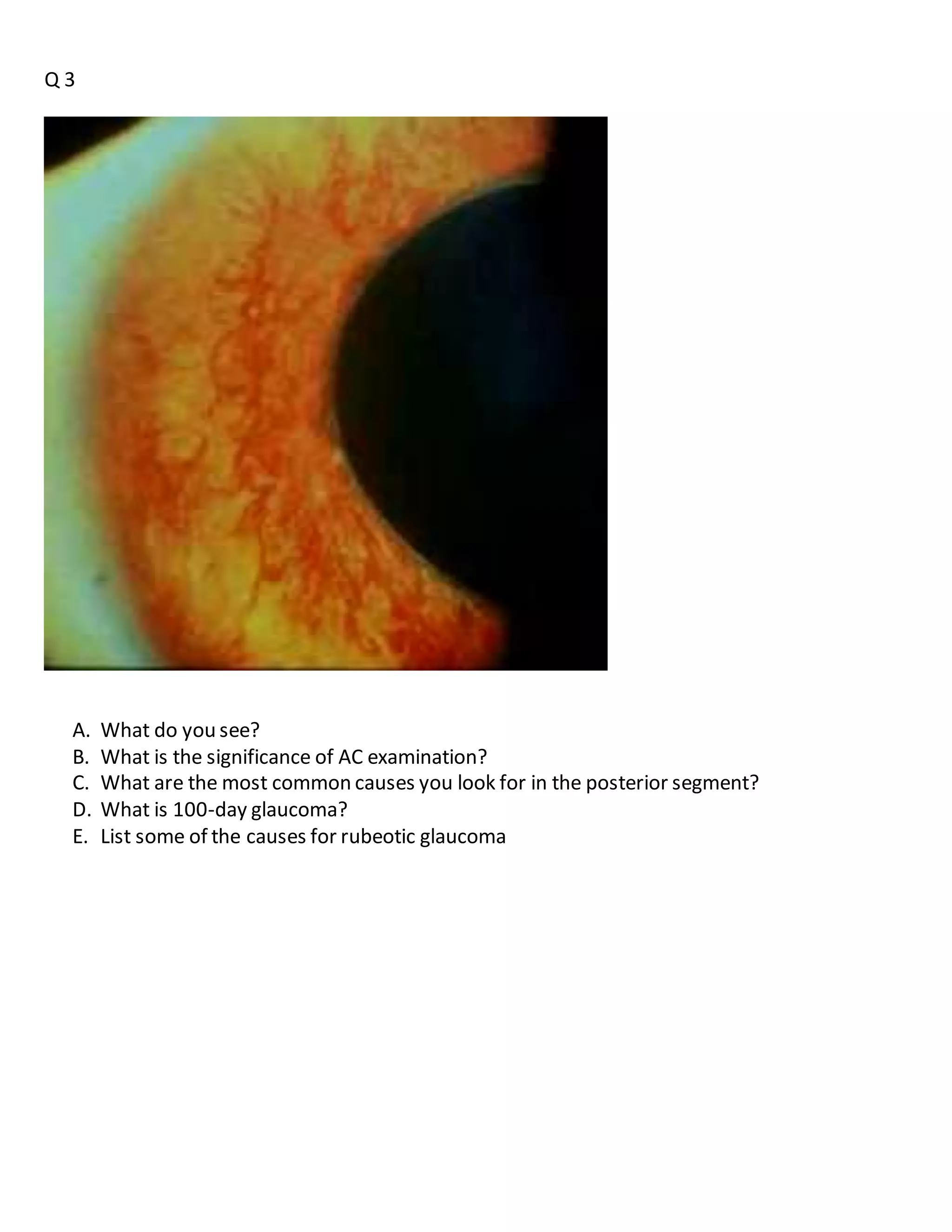 OSCE ophthalmology examination & answers | DOCX