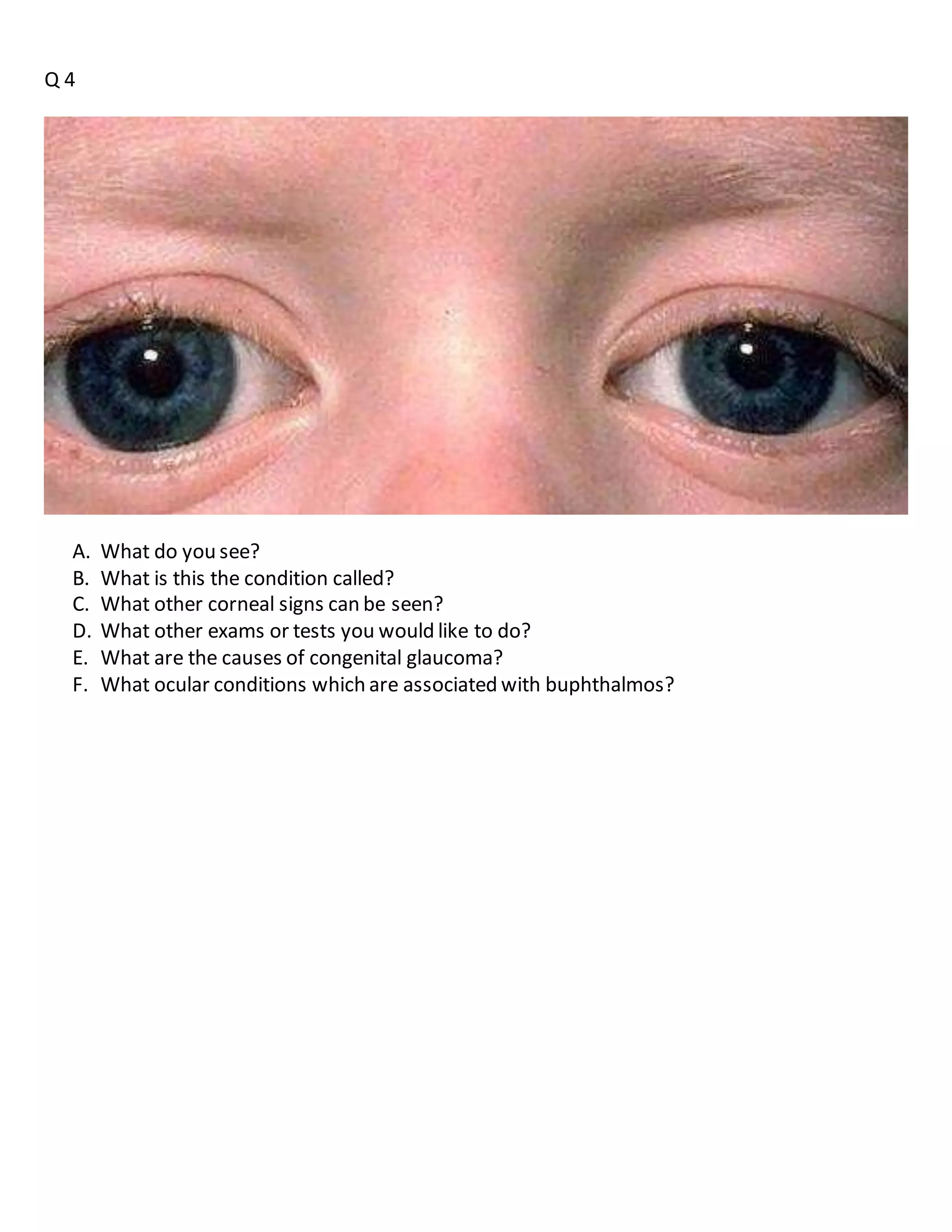 OSCE ophthalmology examination & answers | DOCX