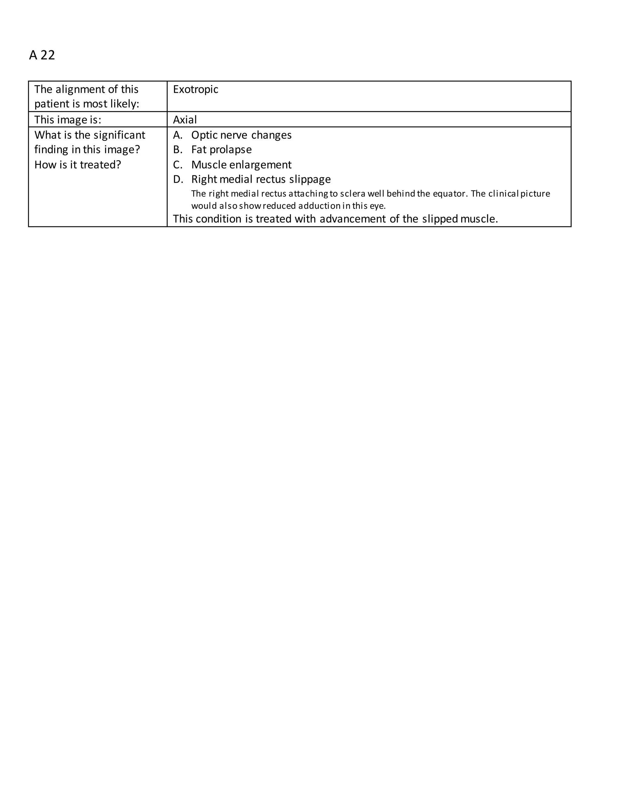 OSCE ophthalmology examination & answers | DOCX