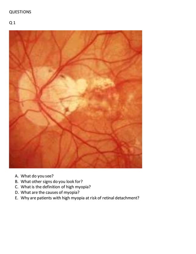 OSCE ophthalmology examination & answers | DOCX | Eye and Vision ...