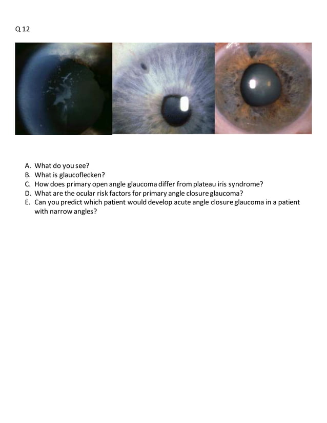OSCE ophthalmology examination & answers | DOCX | Eye and Vision ...