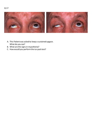 OSCE ophthalmology examination & answers | DOCX