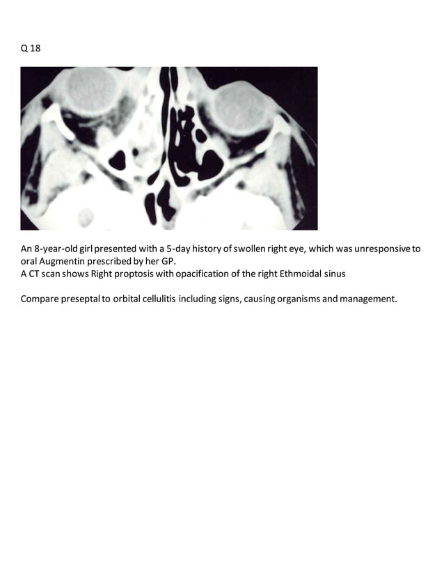 OSCE ophthalmology examination & answers | DOCX | Eye and Vision ...