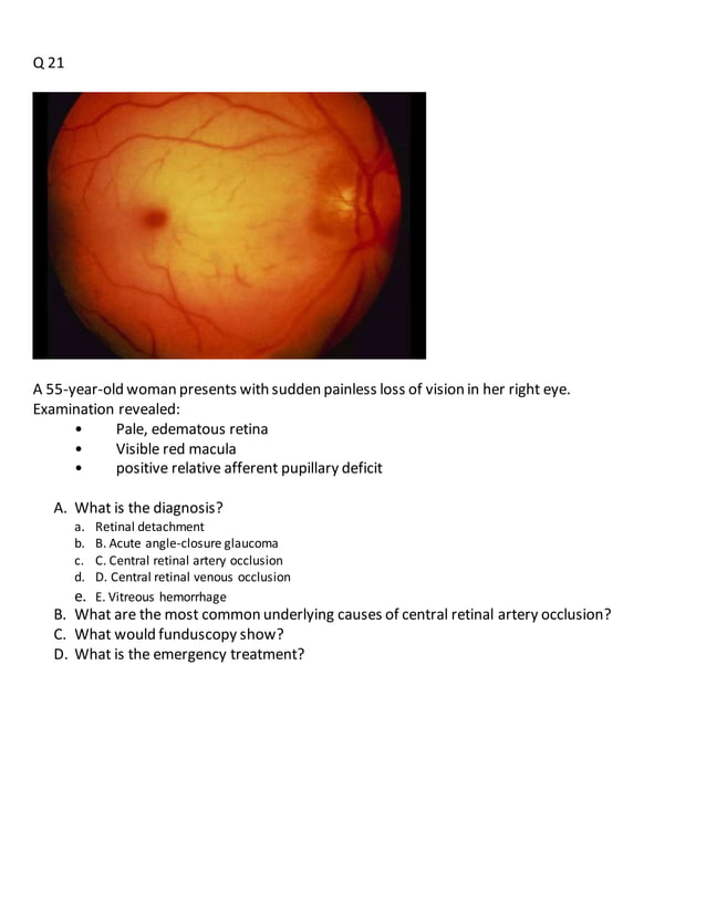 OSCE ophthalmology examination & answers | DOCX | Eye and Vision ...