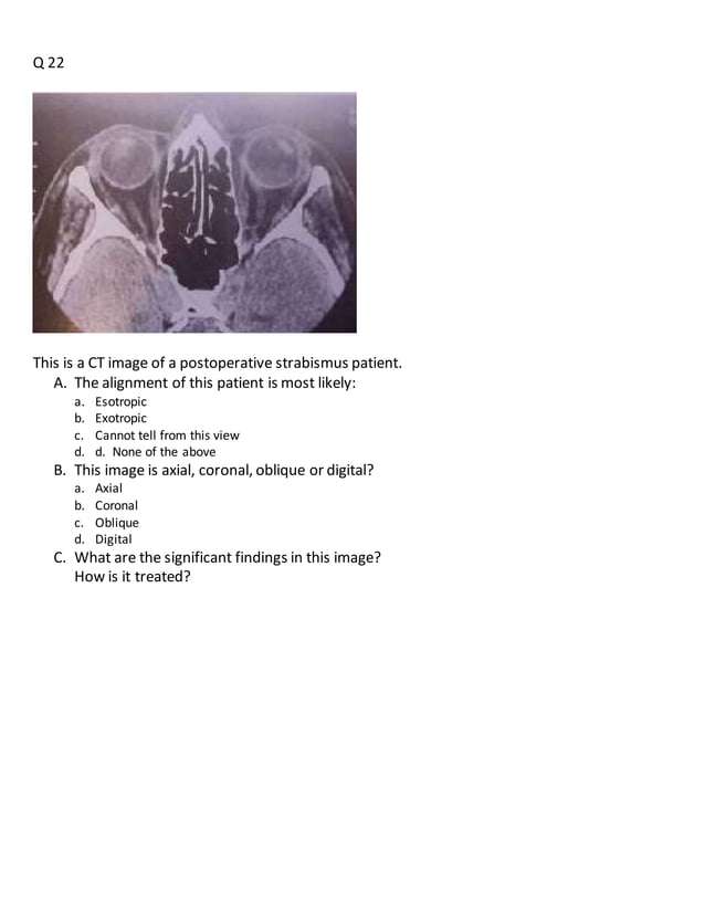 OSCE ophthalmology examination & answers | DOCX | Eye and Vision ...
