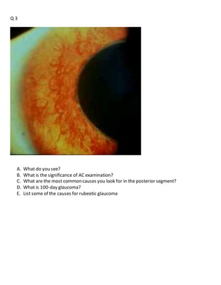 OSCE ophthalmology examination & answers | DOCX