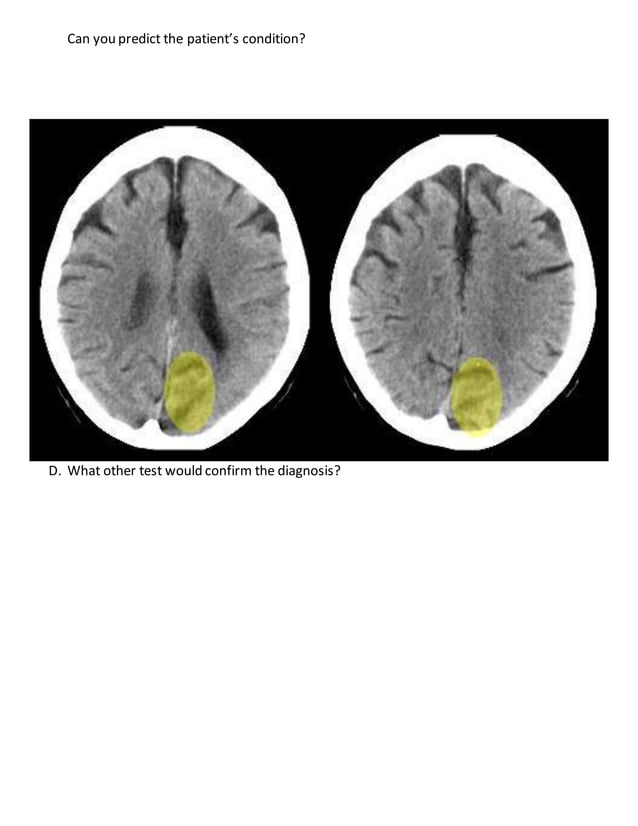 OSCE ophthalmology examination & answers | DOCX | Eye and Vision ...
