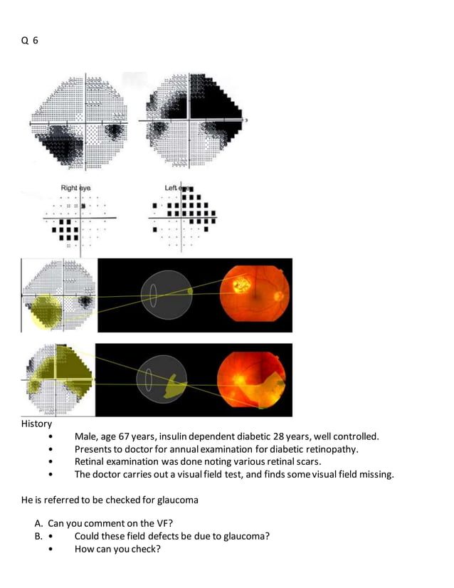 OSCE ophthalmology examination & answers | DOCX | Eye and Vision ...