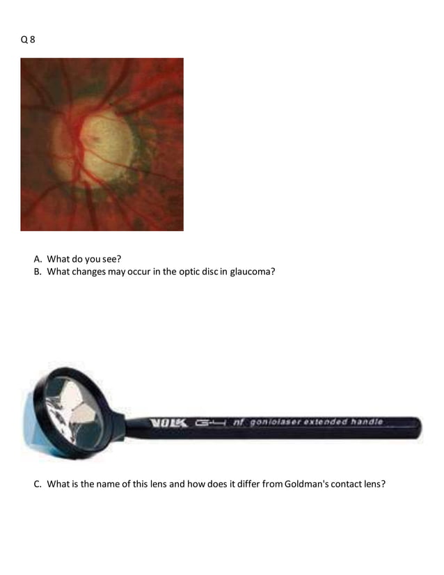 OSCE ophthalmology examination & answers | DOCX | Eye and Vision ...