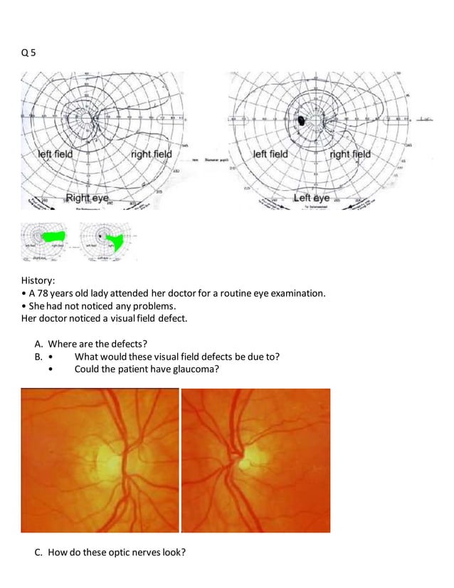 OSCE ophthalmology examination & answers | PDF