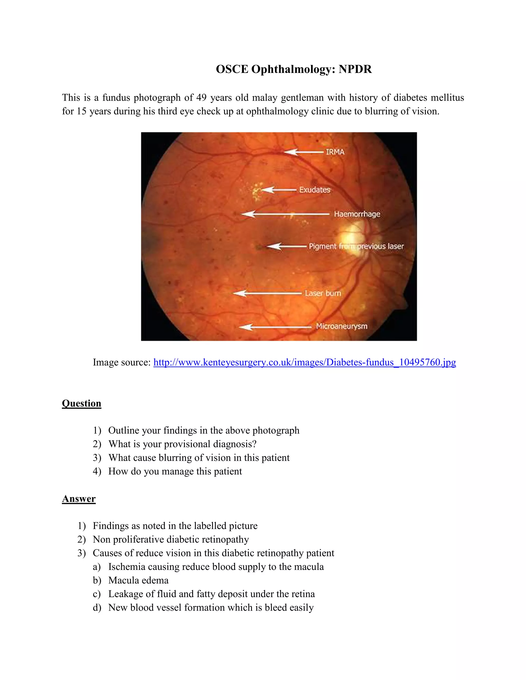 Osce ophthalmology npdr | PDF
