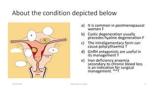 Osce picture in obs and gynae 5 | PPTX
