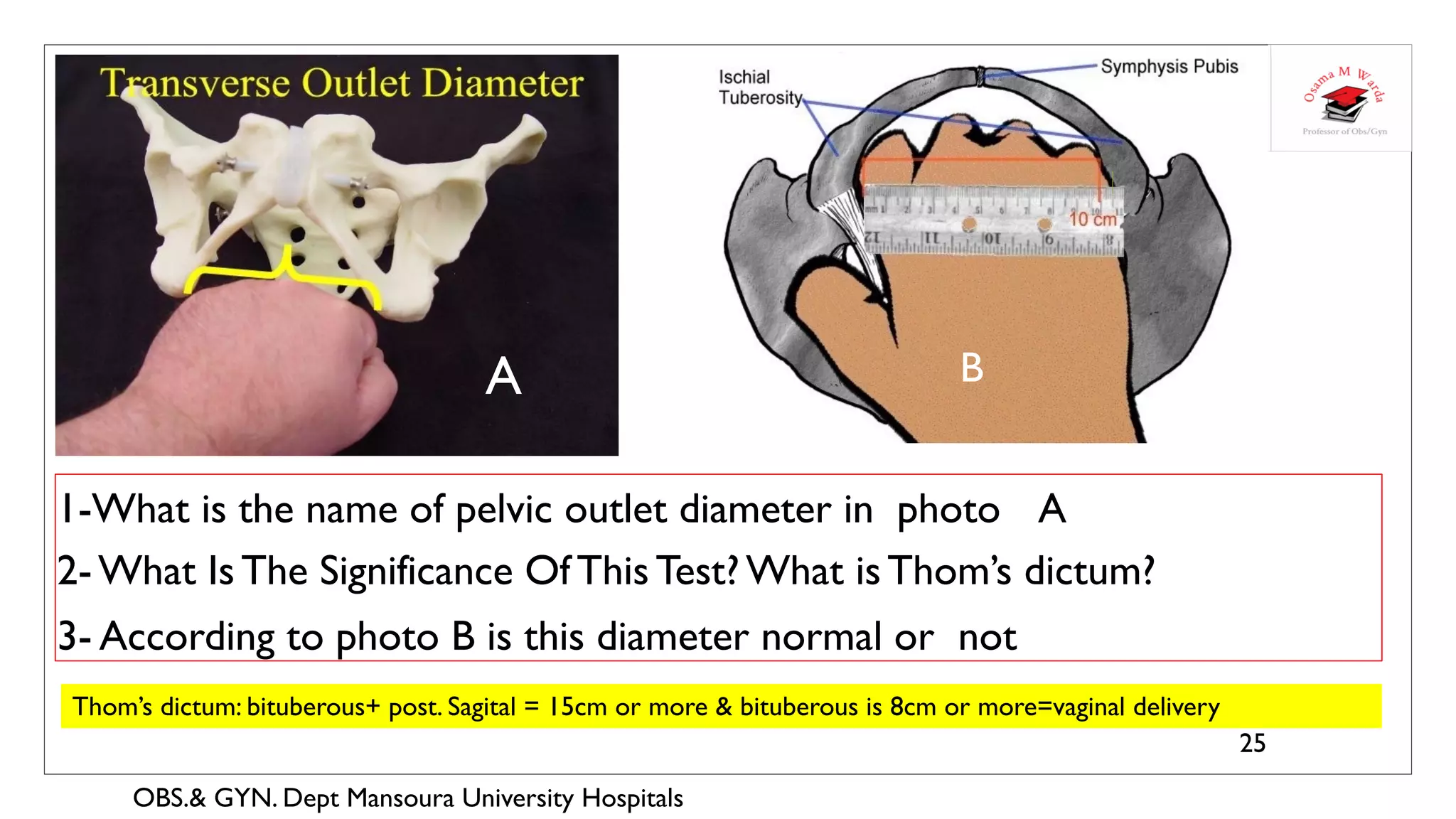 OBSTETRICS & GYNECOLOGY- REVISION-2-WARDA | PDF
