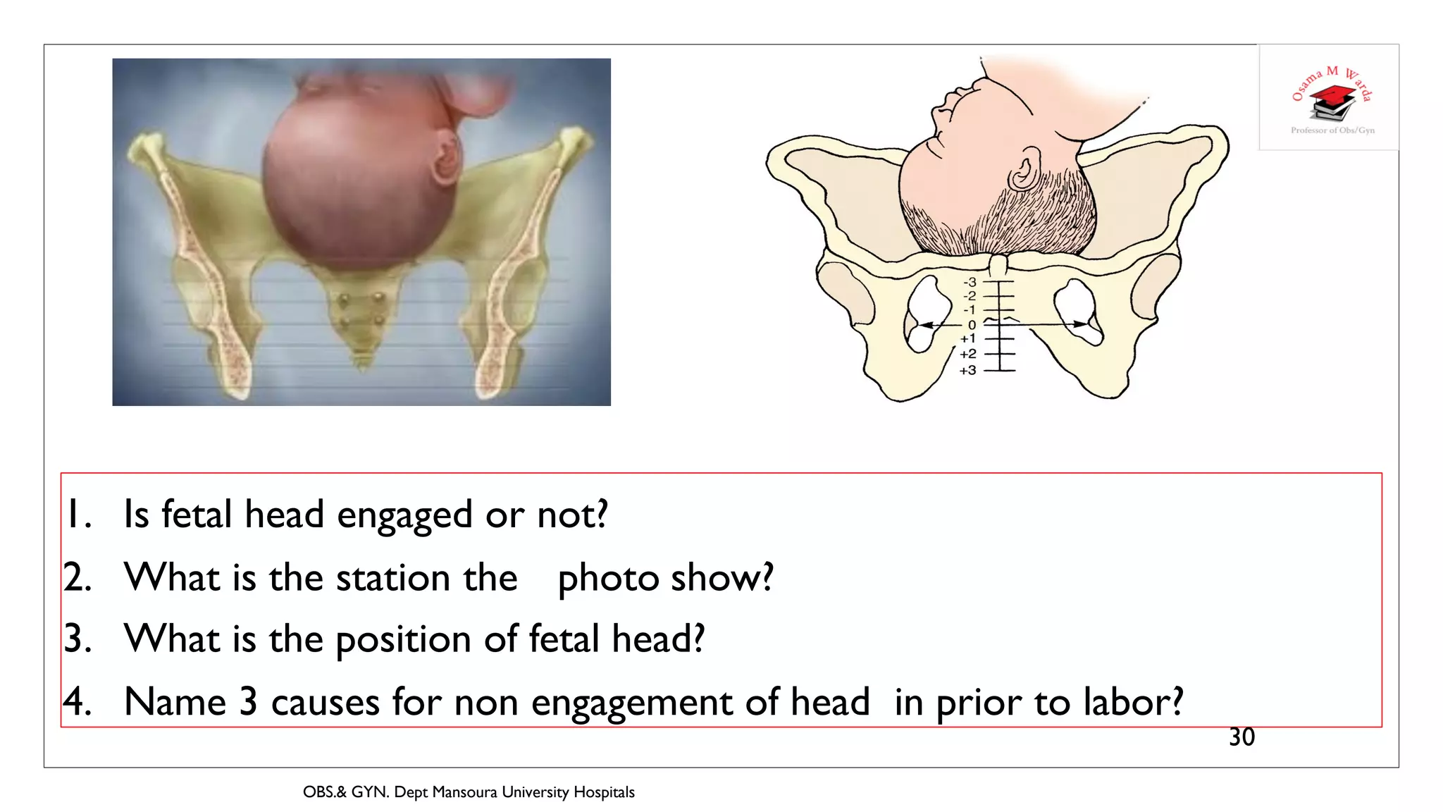 OBSTETRICS & GYNECOLOGY- REVISION-2-WARDA | PDF