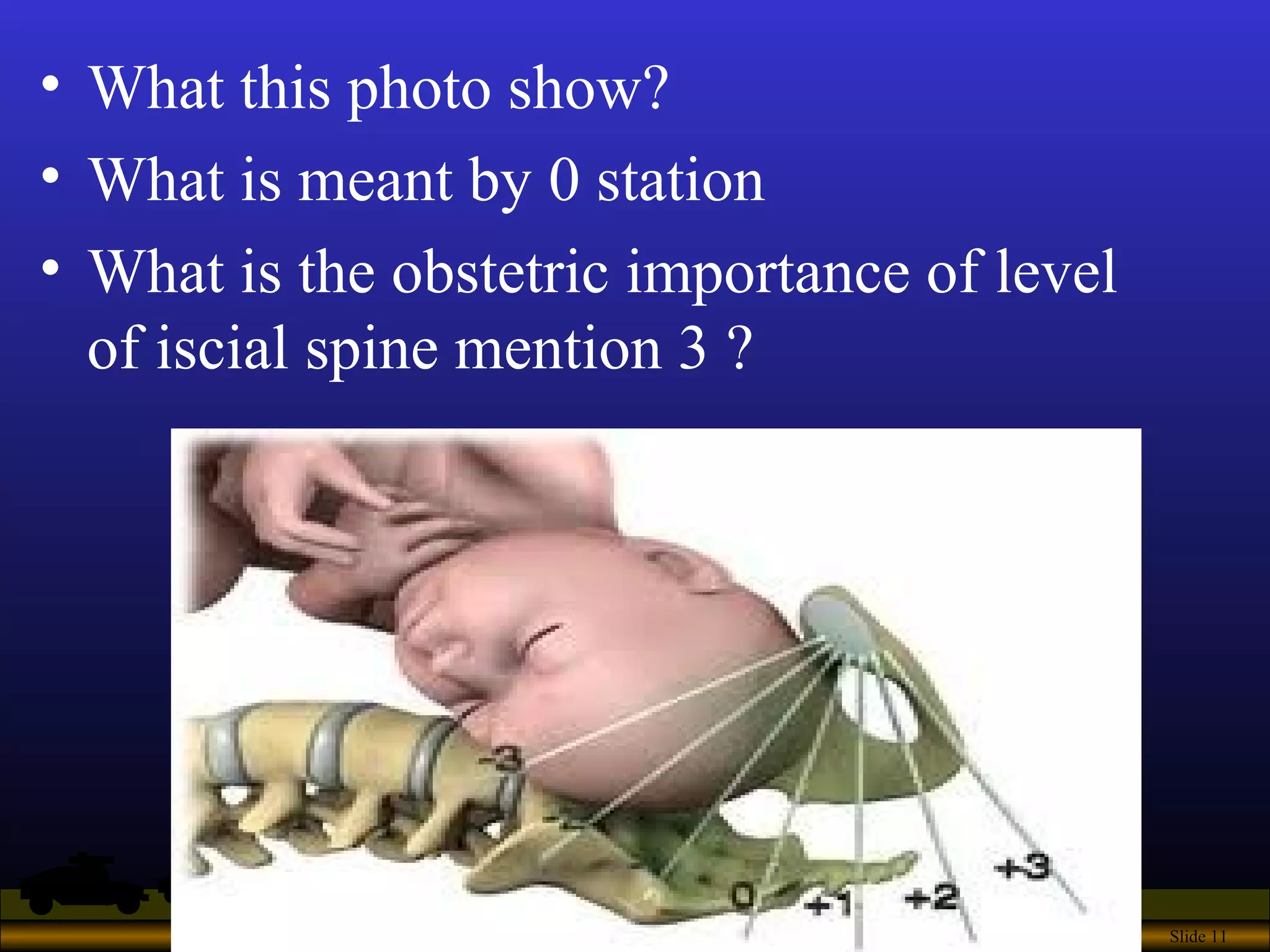 Osce revision in obstetrics and gynecology | PPT