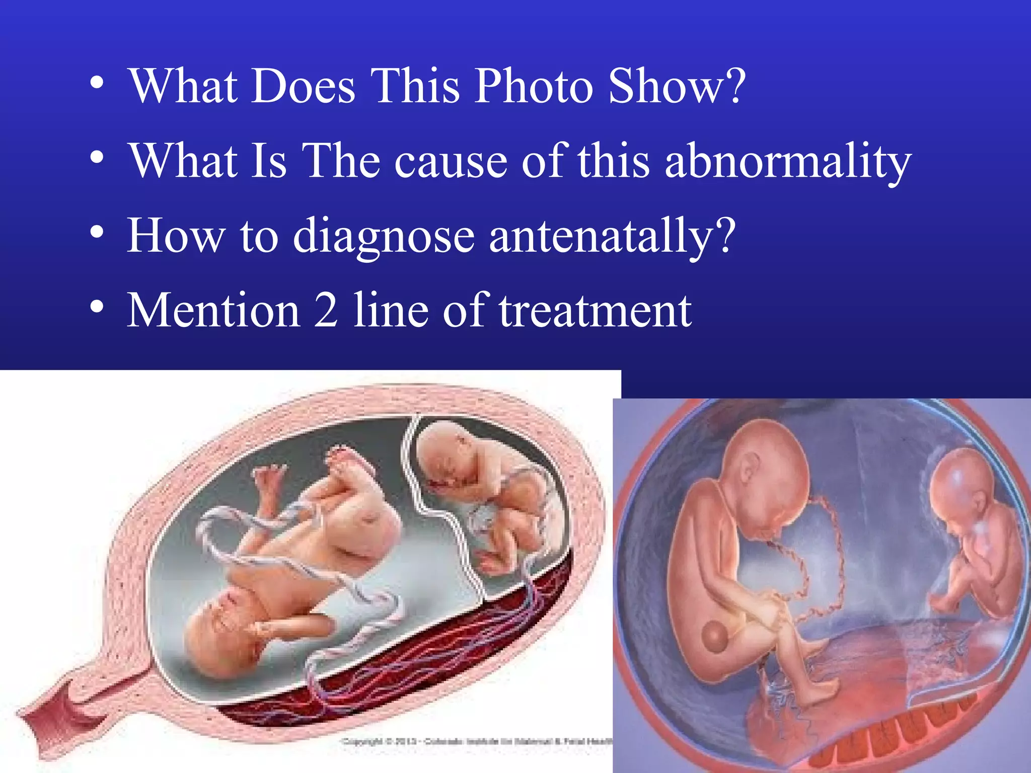 Osce revision in obstetrics and gynecology | PPT