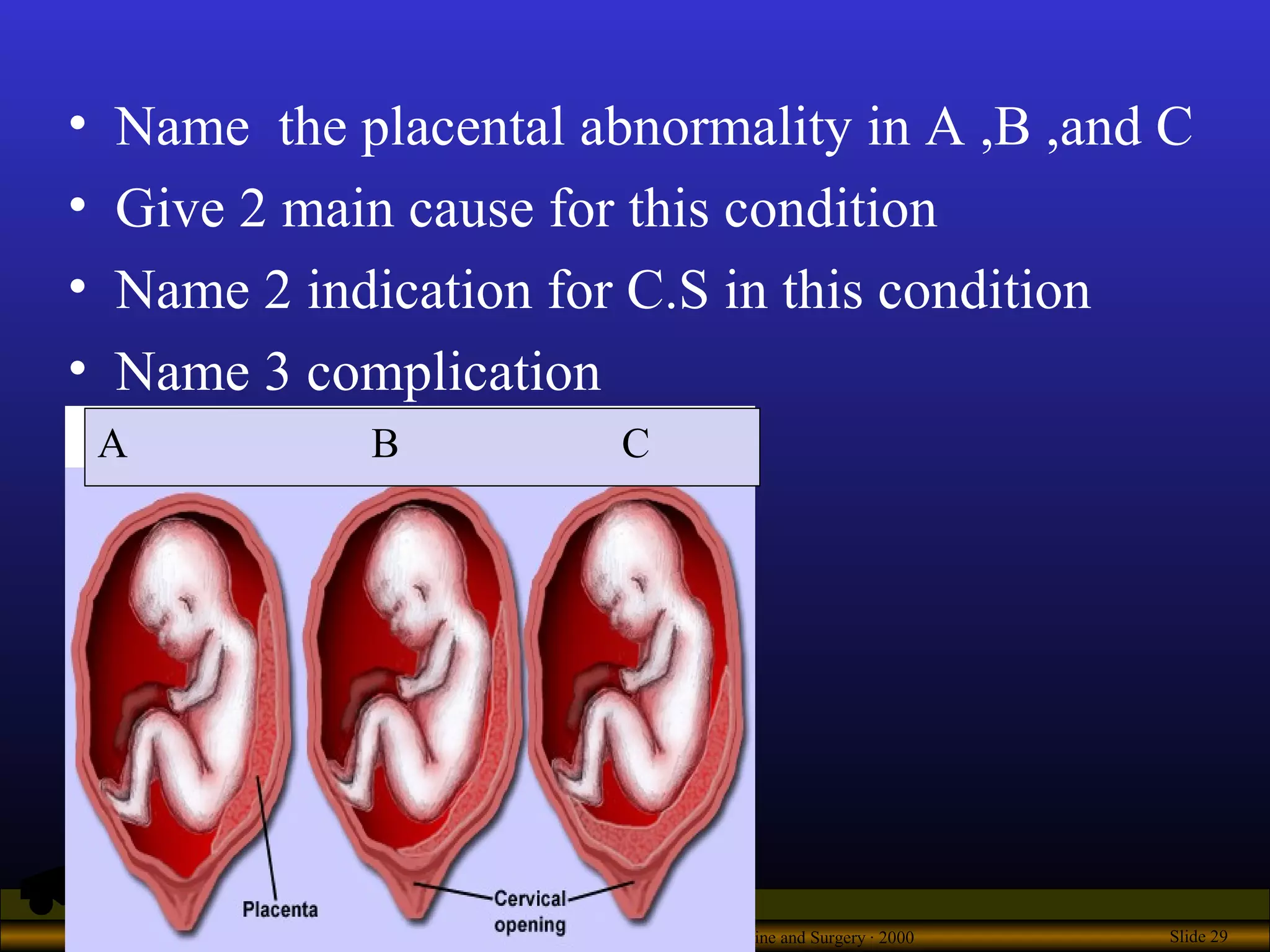 Osce revision in obstetrics and gynecology | PPT