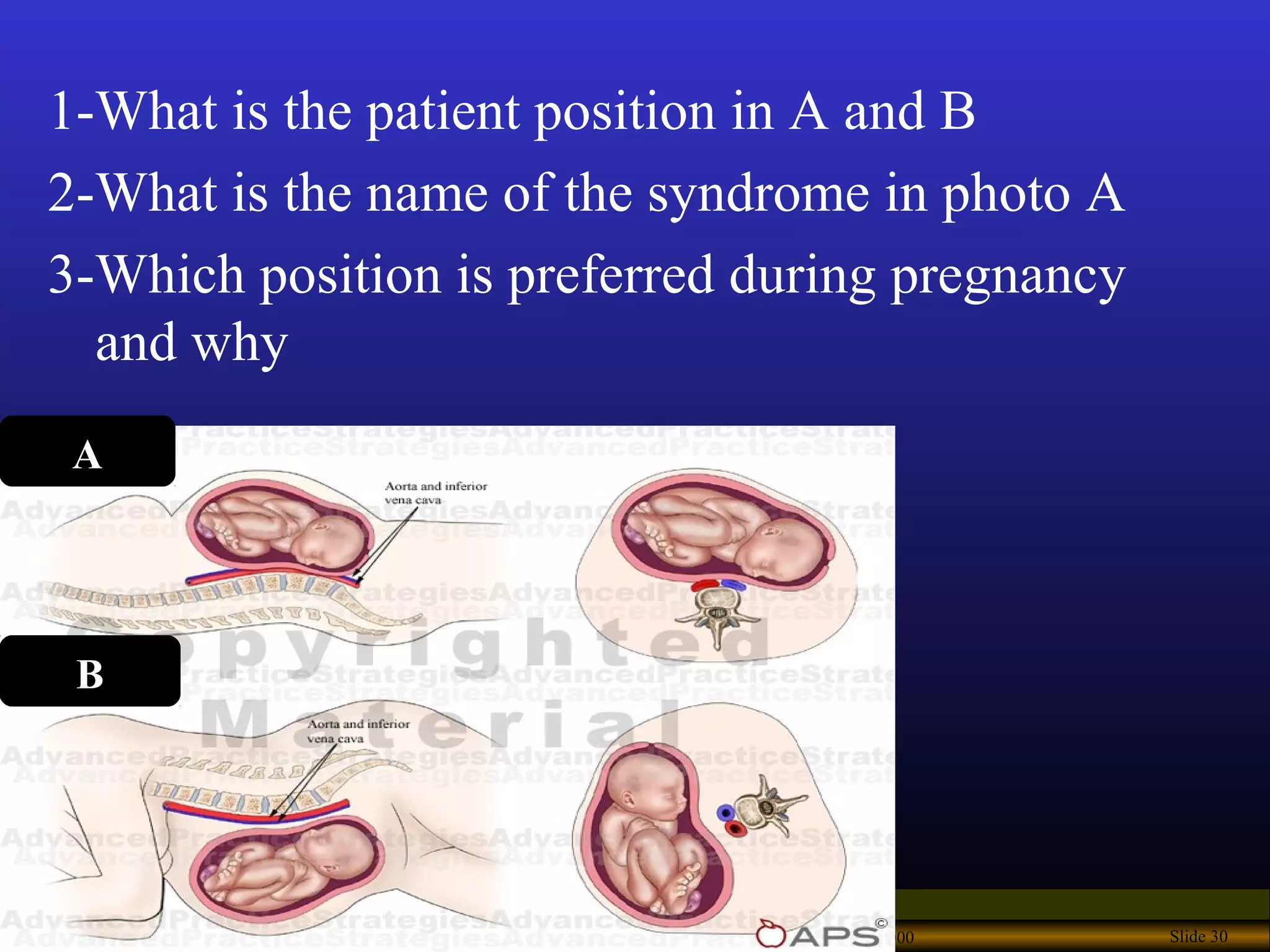 Osce revision in obstetrics and gynecology | PPT