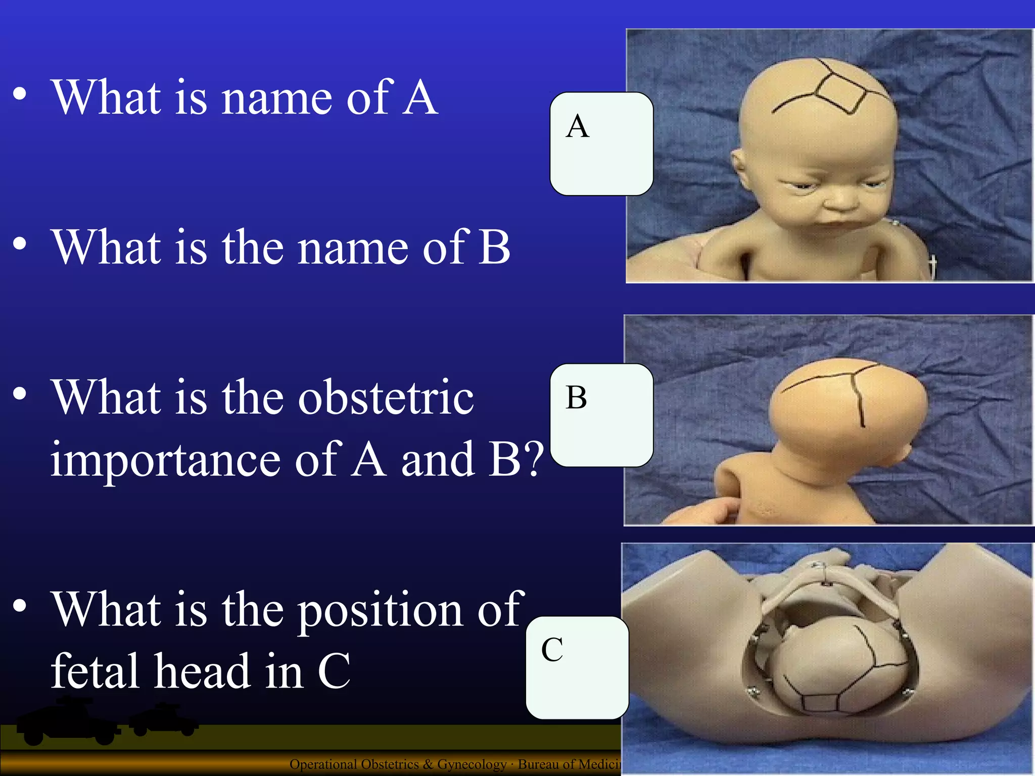 Osce revision in obstetrics and gynecology | PPT | Pregnancy ...