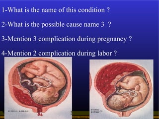 Osce revision in obstetrics and gynecology | PPT