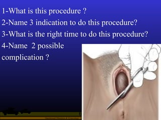 Osce revision in obstetrics and gynecology | PPT