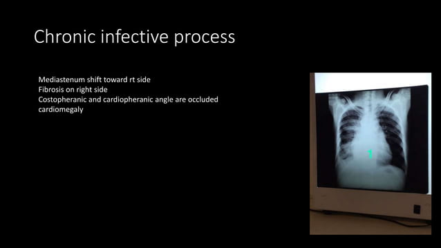 Osces xrays surgery | PPT