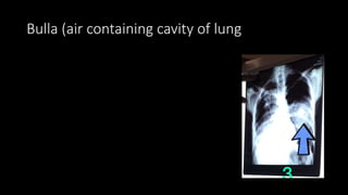 Osces xrays surgery | PPT