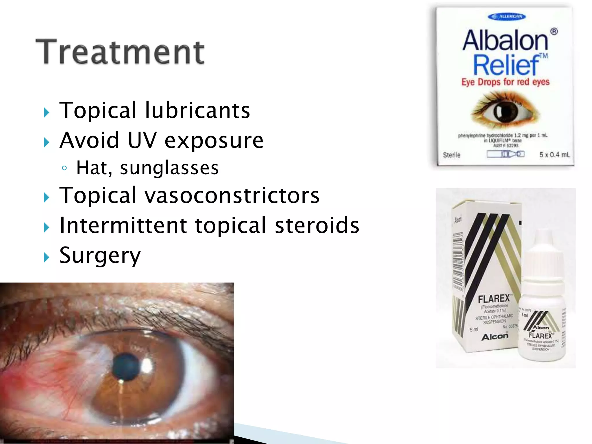 Pterygium Surgery | PPTX