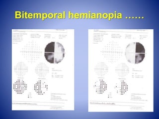 Routine Office Eye Checks for General Practitioners | PPT