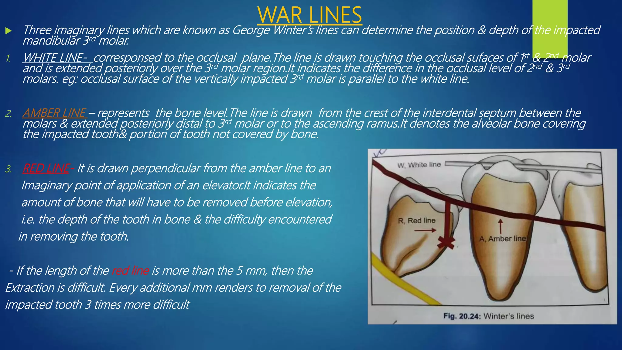 Mandibular 3rd molar impacion | PPTX