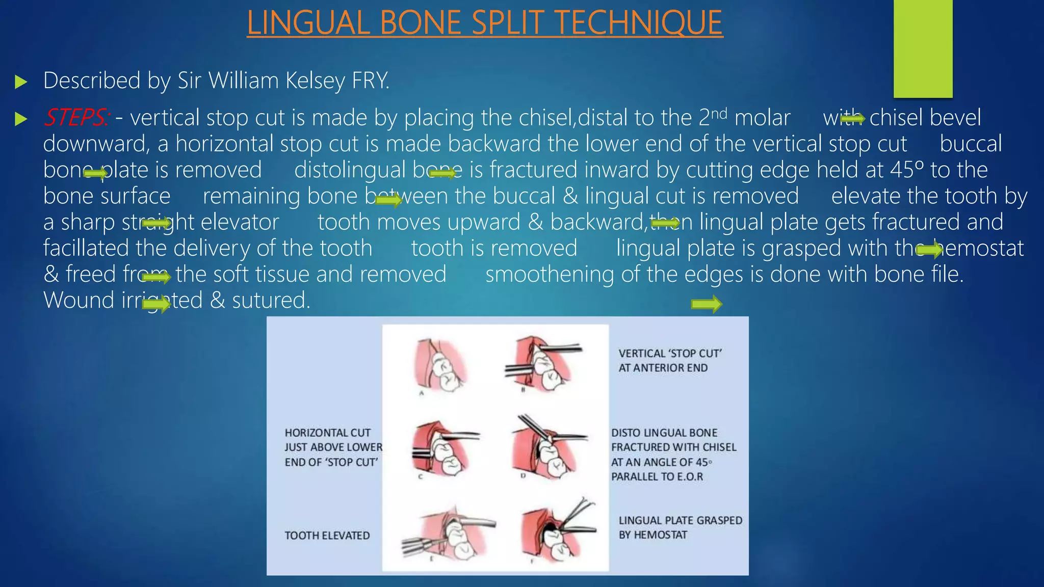 Mandibular 3rd molar impacion | PPTX