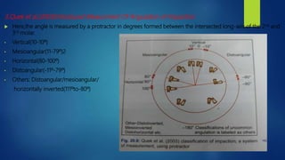 Mandibular 3rd molar impacion | PPT