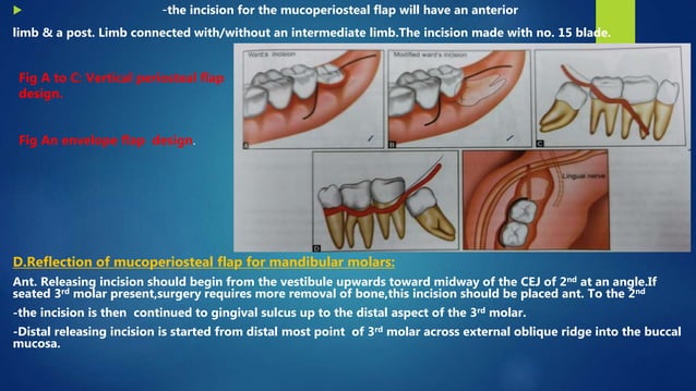 Mandibular 3rd molar impacion | PPT