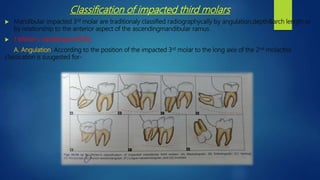 Mandibular 3rd molar impacion | PPT