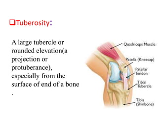Osgood-Schlatter Disease | PPTX