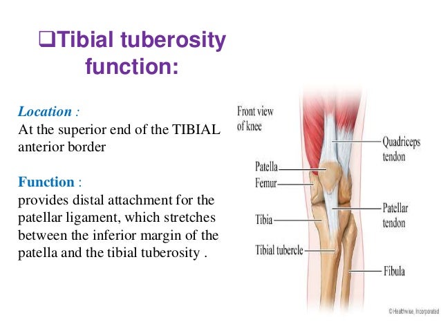 Osgood-Schlatter Disease