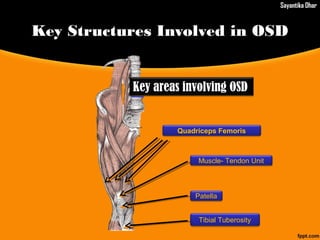 Osgood Schlatter Disease | PPT