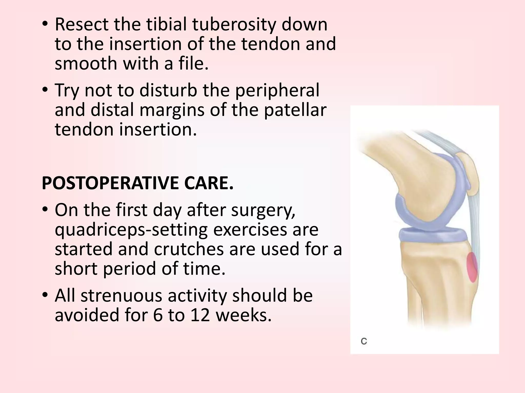 Osgood schlatter disease | PPTX