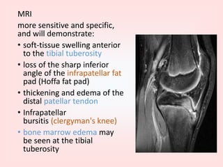 Osgood schlatter disease | PPTX