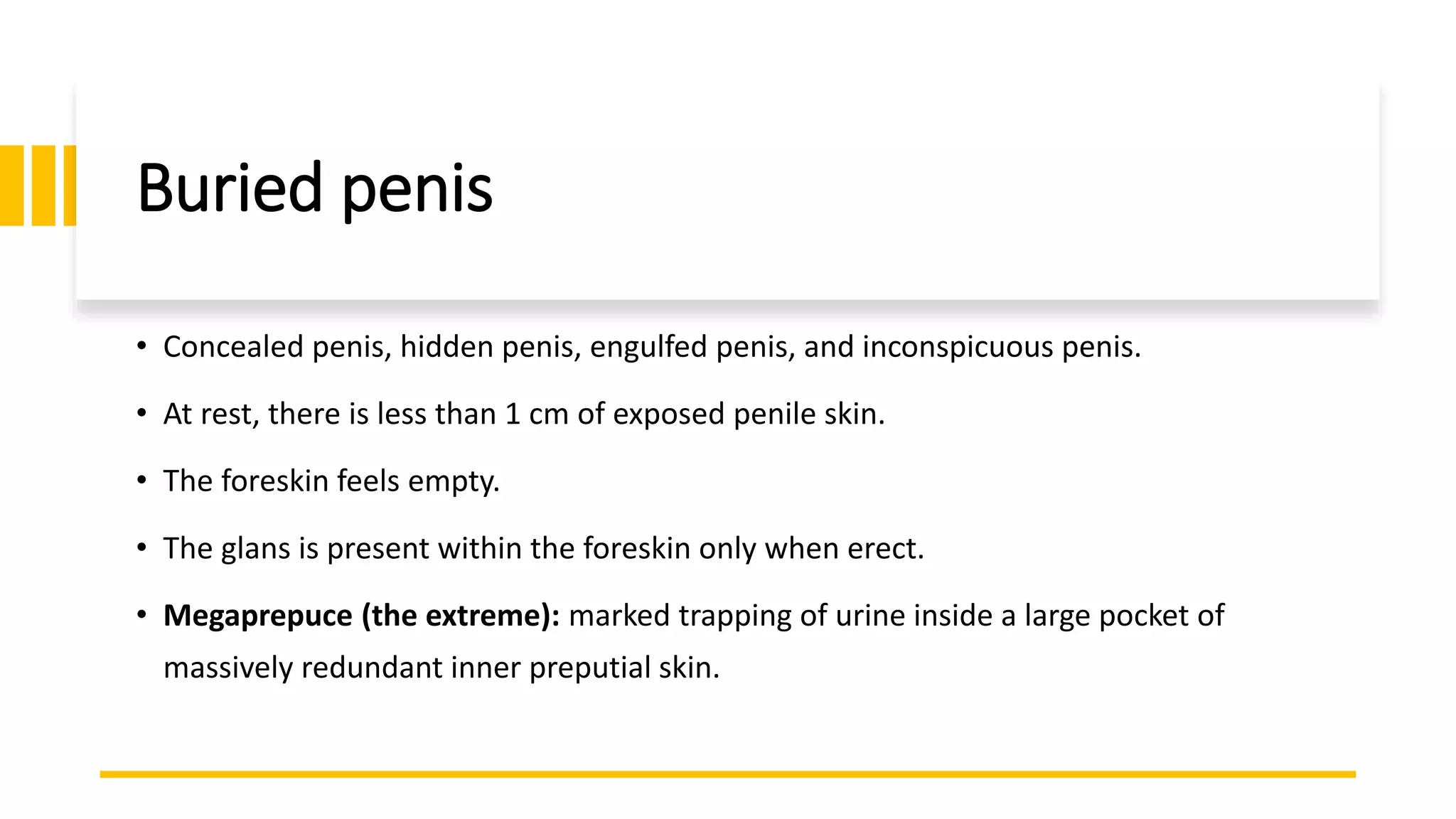 Oshiba circumcision | PPTX