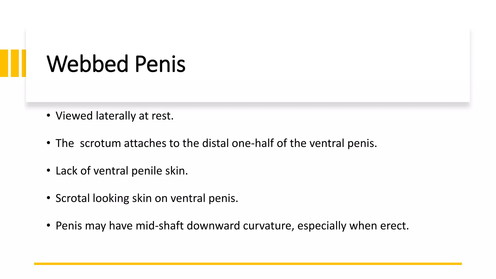 Oshiba circumcision | PPTX