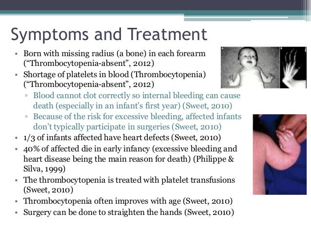 Thrombocytopenia Absent Radius Syndrome