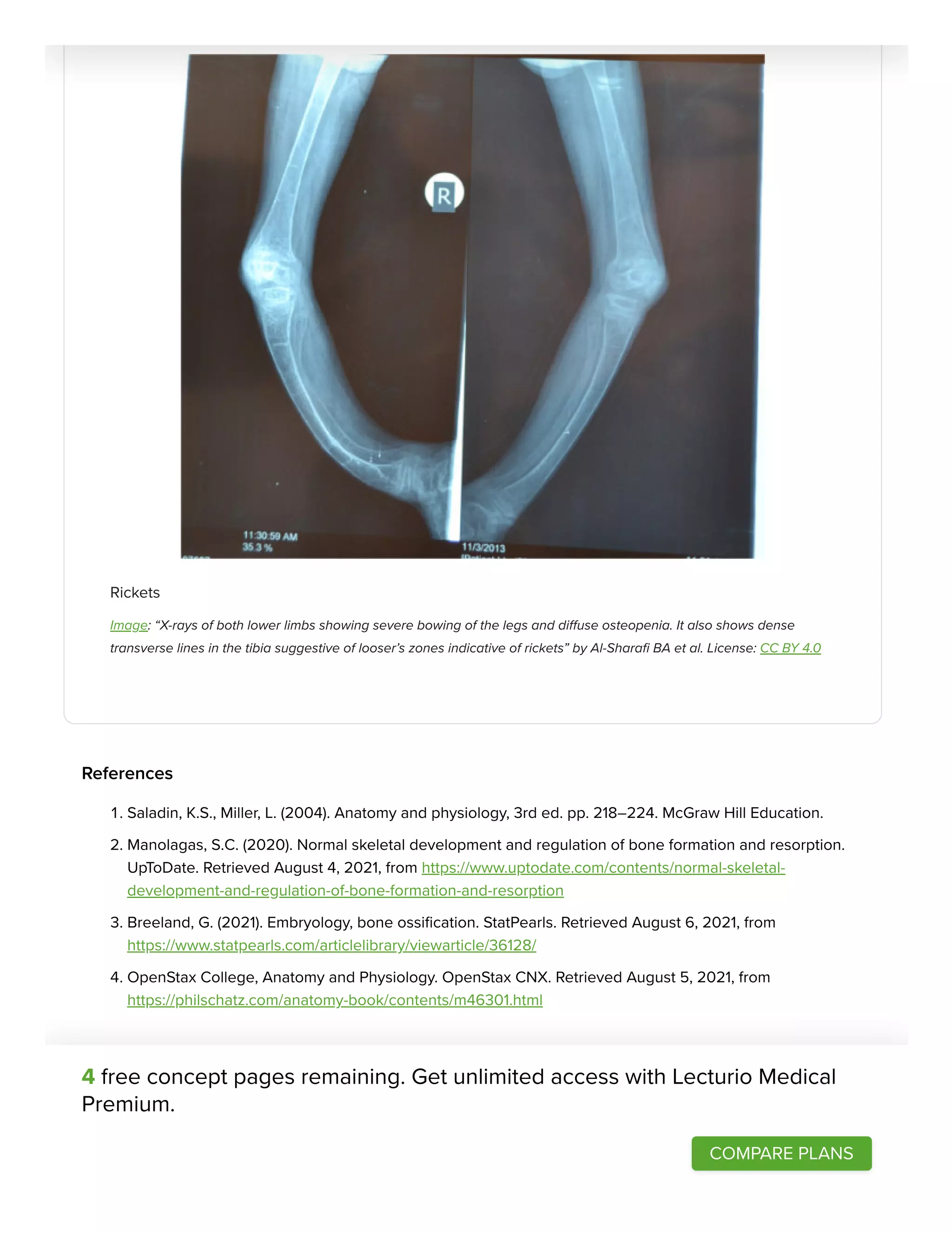 OSIFICACIÓN ÓSEA.pdf