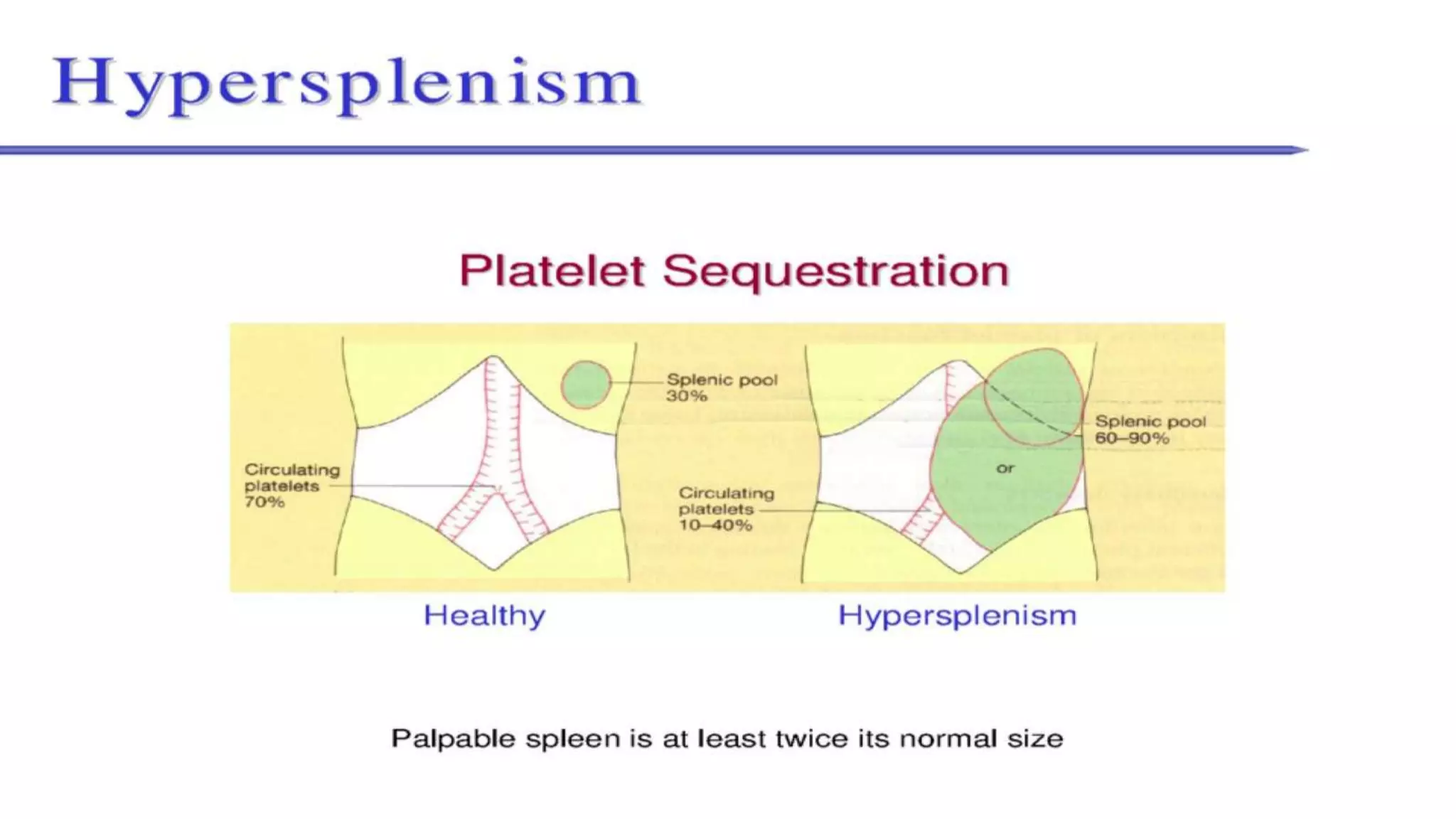 Splenectomy | PPTX