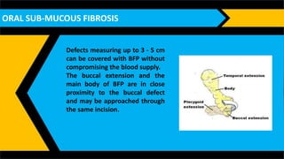 ORAL SUBMUCOUS FIBROSIS (OSMF) | PPTX
