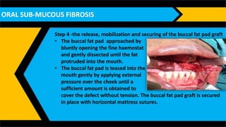ORAL SUBMUCOUS FIBROSIS (OSMF) | PPTX