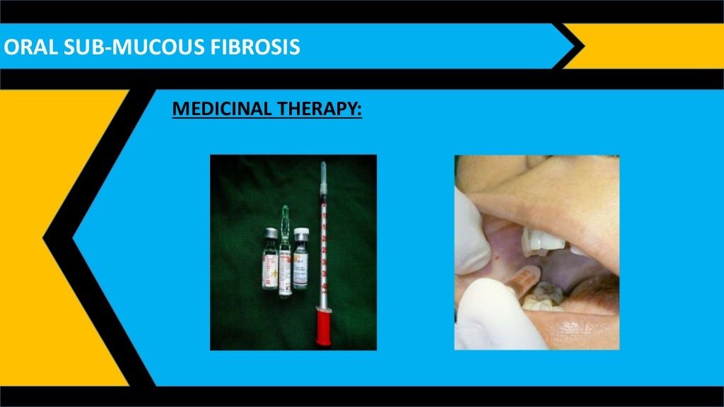 ORAL SUBMUCOUS FIBROSIS (OSMF)