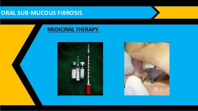 ORAL SUBMUCOUS FIBROSIS (OSMF)